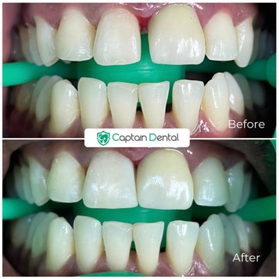 CAPTAIN DENTAL - Updated December 2025 - 34 Photos & 23 Reviews - 1690 ...