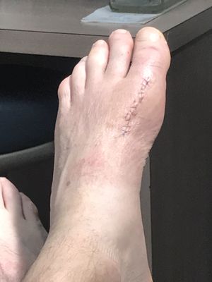 BRUCE I LERMAN, DPM FACFAS - FOOT AND ANKLE MEDICAL GROUP - Updated May ...
