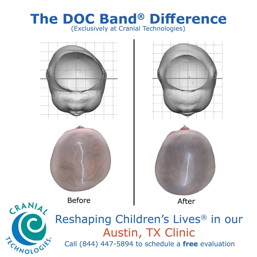 CRANIAL TECHNOLOGIES - Updated September 2025 - 11 Photos & 13 Reviews ...