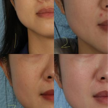 CHENG PLASTIC SURGERY - Updated June 2024 - 144 Photos & 325 Reviews ...