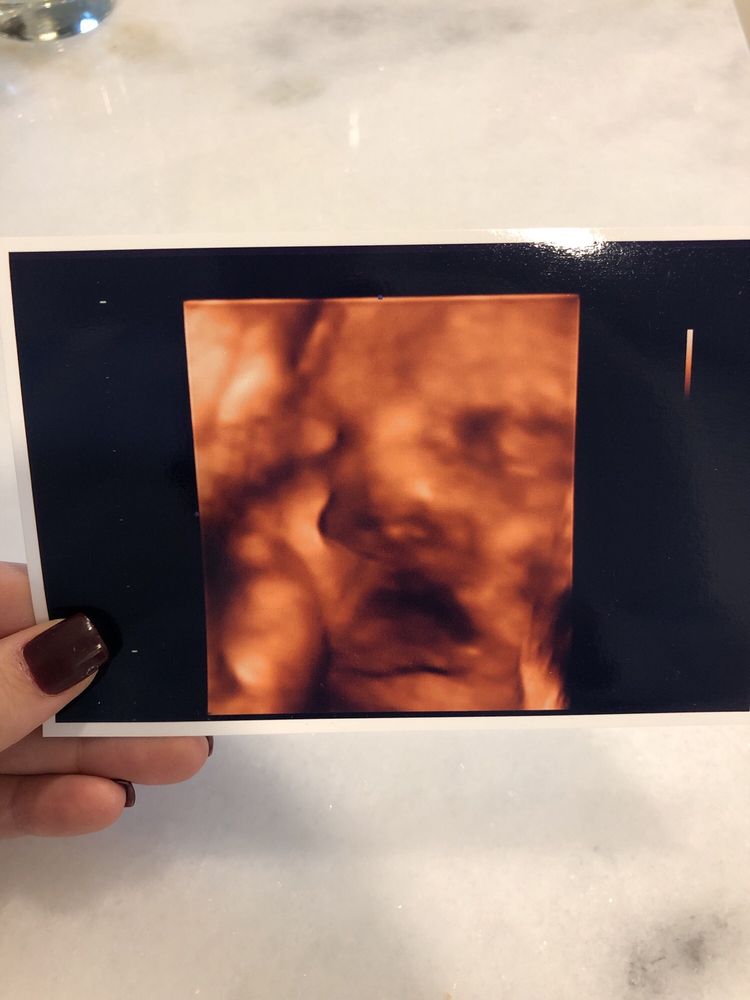 STORK VISION 3D/4D ULTRASOUND GRAPEVINE - 13 Photos & 14 Reviews - 520 ...