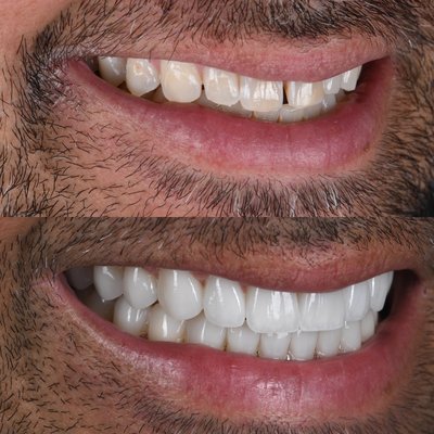 NADER YERMIAN, DDS - VICENTE DENTAL - Updated December 2025 - 134 ...