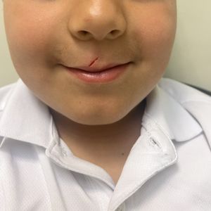 LABCORP - Updated January 2026 - 13 Reviews - 947 S Anaheim Blvd ...