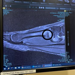 ASCENSION ALL SAINTS HOSPITAL SPRING STREET CAMPUS - Updated April 2025 ...