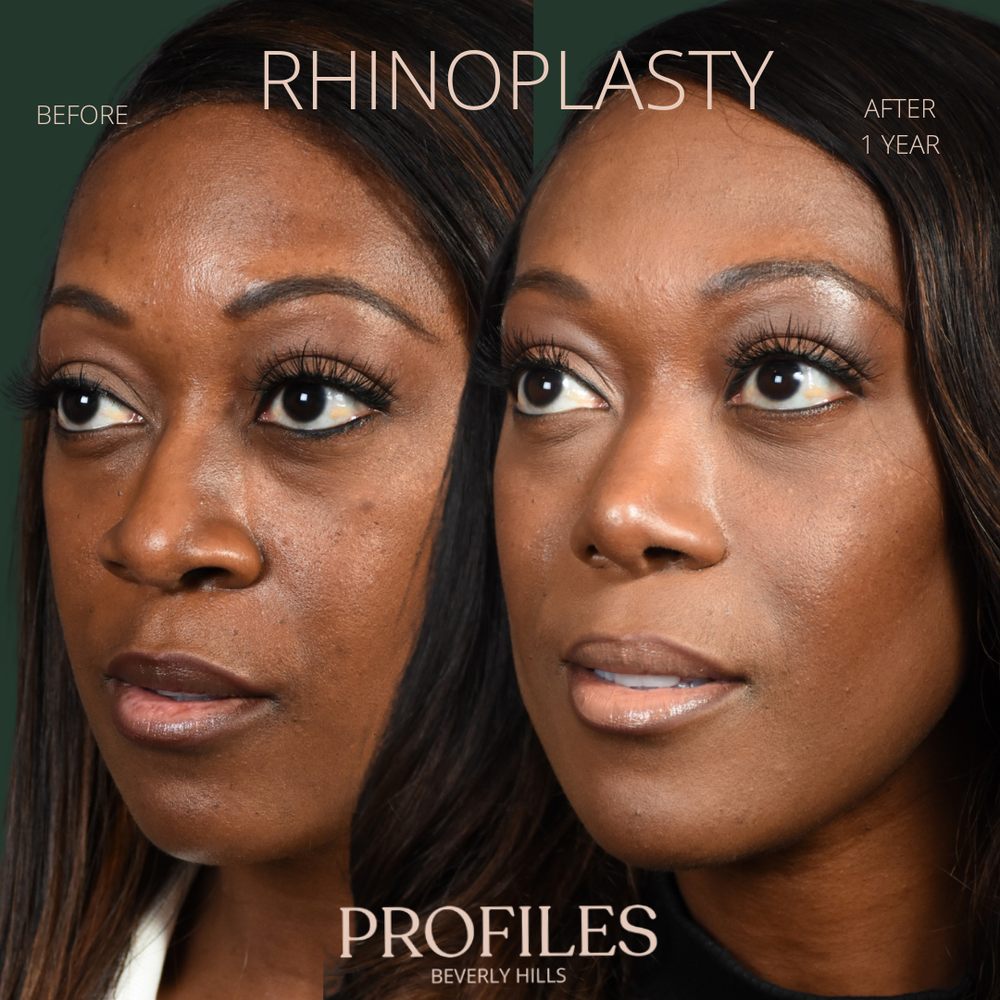 PROFILES BEVERLY HILLS - Updated March 2025 - 66 Photos & 24 Reviews ...