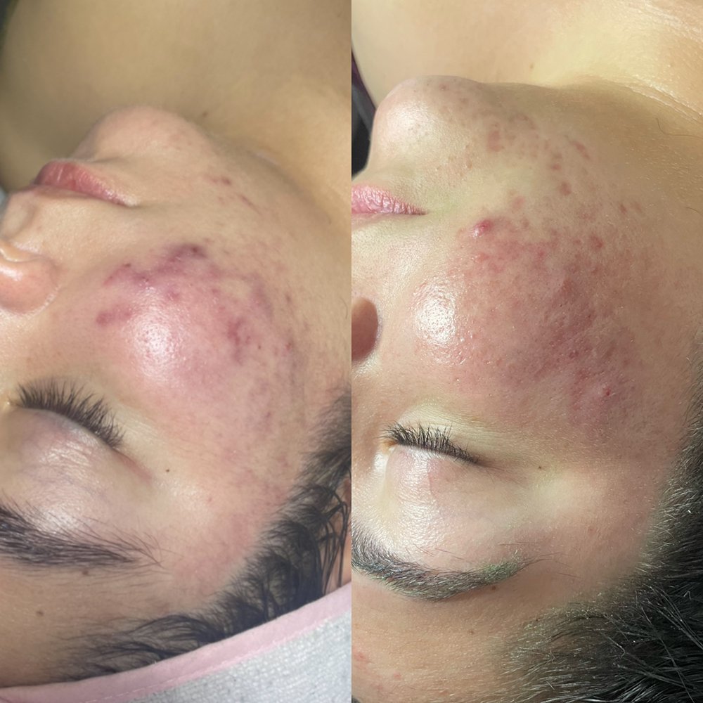 SUNDARA ESTHETICS - Updated June 2024 - 2000 W 120th Ave, Westminster ...