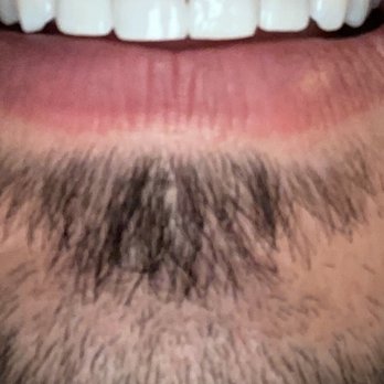 CHICO DENTAL ARTS - Updated December 2025 - 11 Photos & 32 Reviews ...