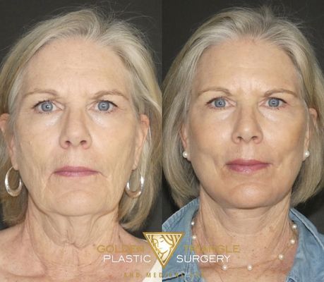 GOLDEN TRIANGLE PLASTIC SURGERY AND MEDICAL SPA - Updated December 2025 ...