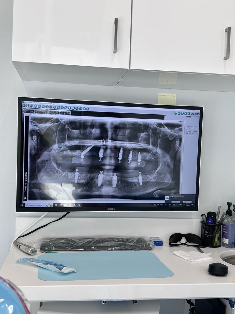 TOOTH BY SUNNY BADYAL, DDS - Updated December 2025 - 21 Photos & 85 ...