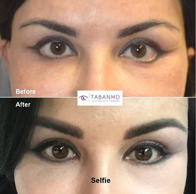 MEHRYAR RAY TABAN MD - OCULOPLASTIC SURGEON - Updated December 2025 ...