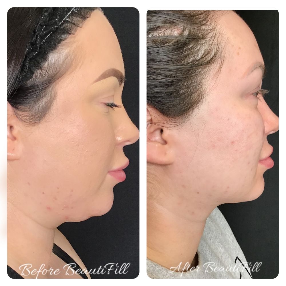 THE BOTOX BAR AND AESTHETICS - Updated December 2025 - 74 Photos - 801 ...