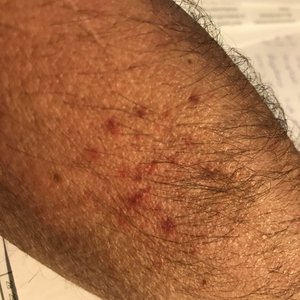 FRONTLINE PEST CONTROL - Updated November 2025 - 14 Photos & 83 Reviews ...