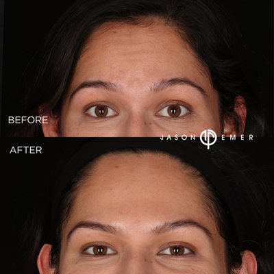 JASON EMER, MD - 995 Photos & 382 Reviews - 9201 Sunset Blvd, West ...