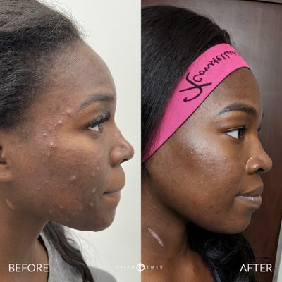 JASON EMER, MD - Updated December 2025 - 1166 Photos & 520 Reviews ...