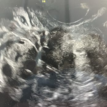 CHANDRA SPRING-ROBINSON, DO, FACOG - Updated August 2025 - 777 N El ...