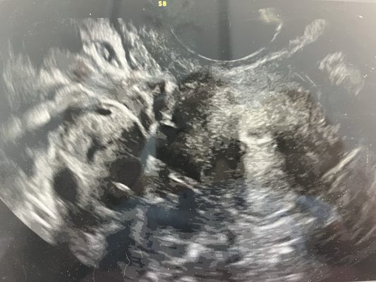 CHANDRA SPRING-ROBINSON, DO, FACOG - Updated October 2025 - 777 N El ...