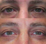 WARREN C STOUT, MD - Updated May 2026 - 21 Photos & 43 Reviews - 800 E ...