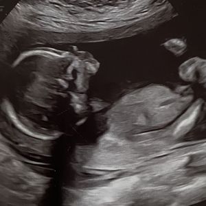 TOURO IMAGING CENTER - Updated September 2025 - 12 Reviews - 2929 ...