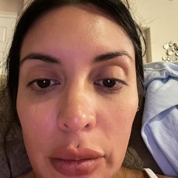 SDBOTOX - MISSION VALLEY - Updated June 2025 - 98 Photos & 269 Reviews ...