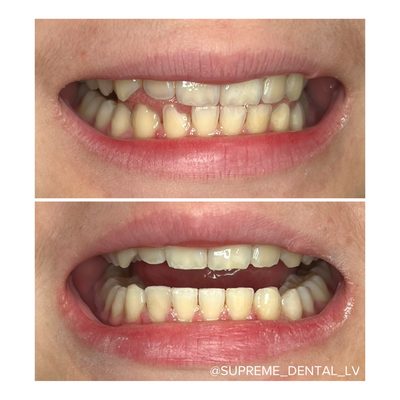 SUPREME DENTAL - Updated February 2025 - 152 Photos & 277 Reviews ...