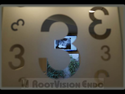 ROOTVISION ENDO - Updated June 2024 - 45 Photos & 192 Reviews - 3663 ...