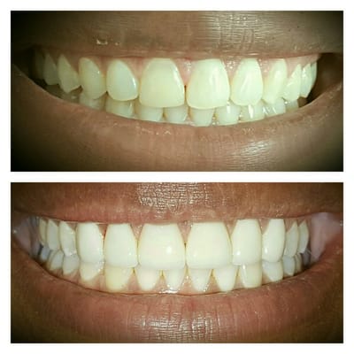 EMPIRE DENTAL NY, PC - Updated May 2026 - 44 Photos & 58 Reviews - 980 ...