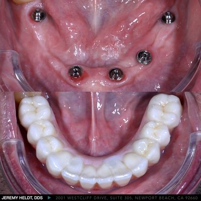 JEREMY HELDT, DDS - Updated May 2024 - 226 Photos & 98 Reviews - 2001 ...