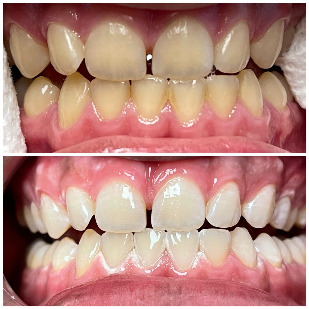 MIAMI WHITENING - Updated February 2025 - 10 Photos - 4801 S University ...