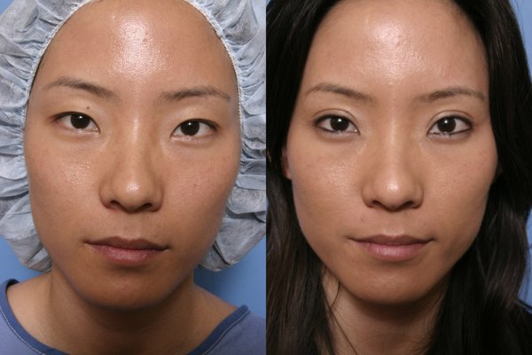 VIP PLASTIC SURGERY - Updated August 2025 - 112 Photos & 72 Reviews ...