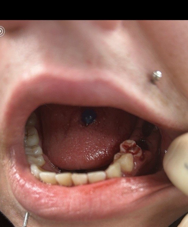 BLACKSTONE DENTAL - Updated October 2025 - 1044 Broad St, Central Falls ...