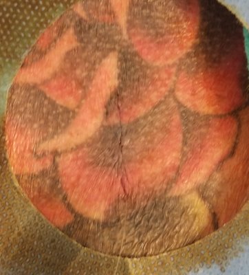 CENTER FOR DERMATOLOGY & PLASTIC SURGERY - Updated December 2025 - 25 ...