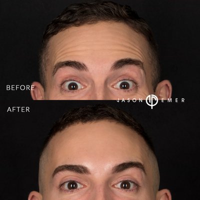 JASON EMER, MD - Updated July 2024 - 1041 Photos & 464 Reviews - 9201 ...