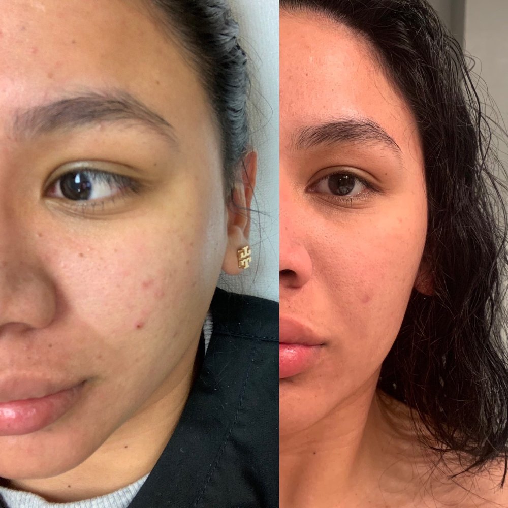 NOVAK LASER BOUTIQUE - Updated January 2025 - 47 Photos & 33 Reviews ...