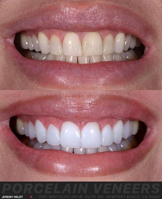 JEREMY HELDT, DDS - 230 Photos & 92 Reviews - 2001 Westcliff Dr ...