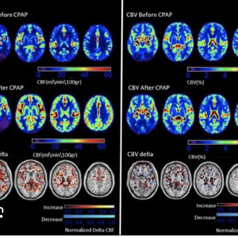 NEXT GEN SLEEP - Updated January 2026 - 10 Photos & 26 Real Reviews ...
