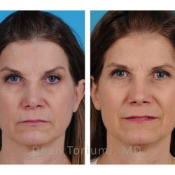 DEAN TORIUMI, MD - 47 Photos & 35 Reviews - 60 E Delaware Pl, Chicago ...