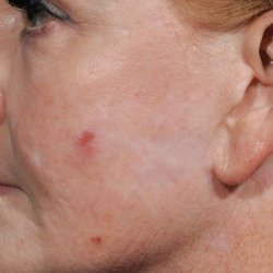 ROD ROHRICH, MD - 14 Reviews - Plastic Surgeons - 9101 N Central Expy ...