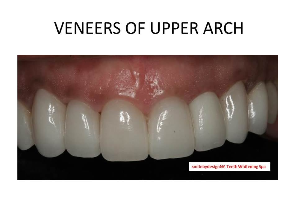 GARY TURNIER, DMD - SMILE BY DESIGNNY - Updated December 2025 - 37-30 ...