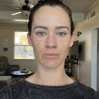 GLO MED SPA AUSTIN - Updated October 2025 - 101 Photos & 47 Reviews - 9801 Anderson Mill Rd ...