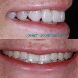 JOSEPH GOODMAN, DDS, DMD - 97 Photos & 124 Reviews - 241 1/2 S Beverly ...