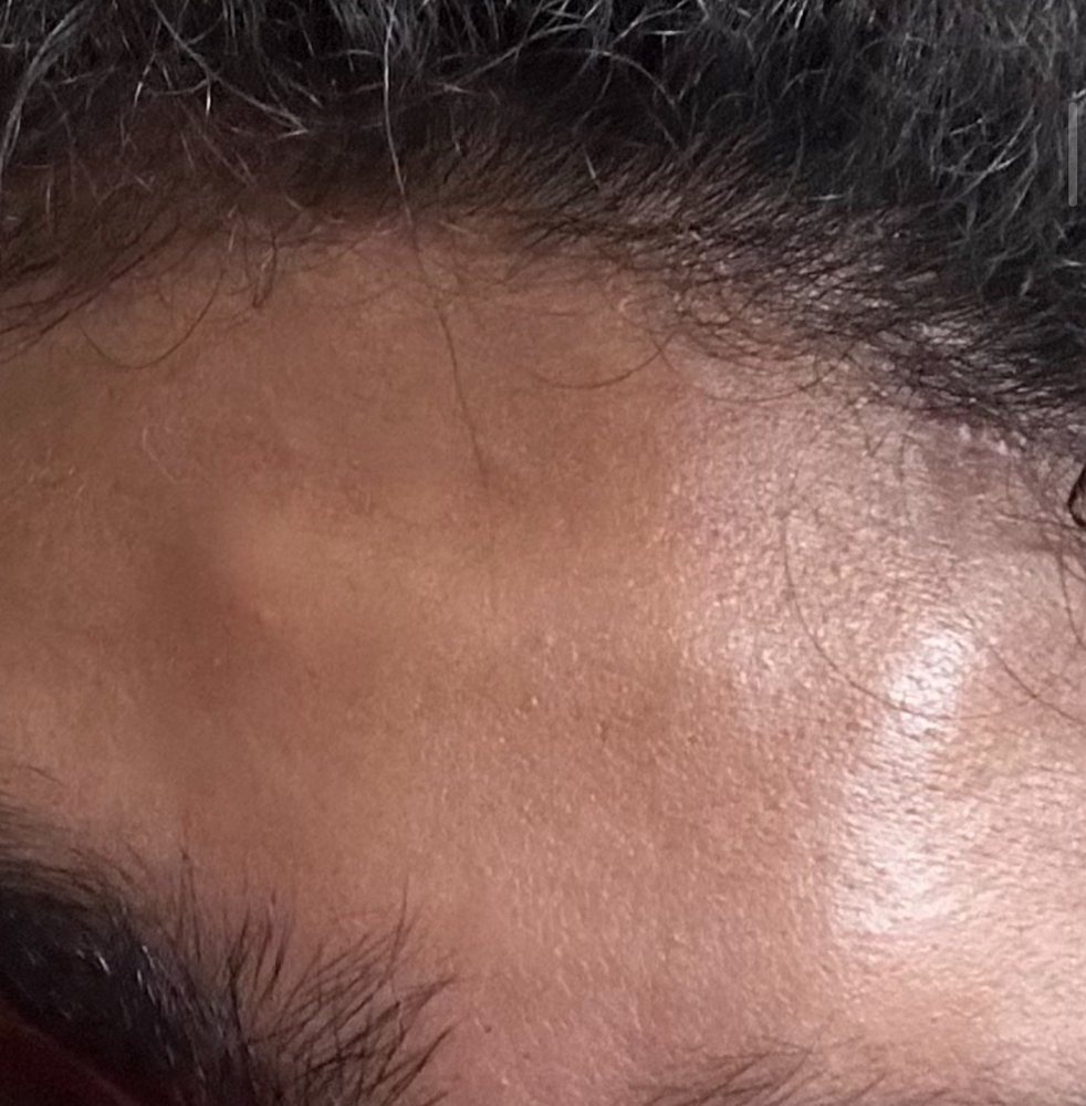 NICHOLAS BASTIDAS, MD - Updated December 2025 - 715 Park Ave, New York ...