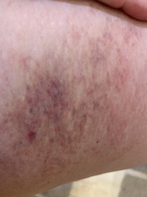 WAXING STATION BY GLOW MED SPA - Updated May 2025 - 31 Photos & 105 ...