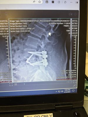 RAMIN RAISZADEH, MD - SPINE AND BRAIN INSTITUTE OF SAN DIEGO - Updated ...