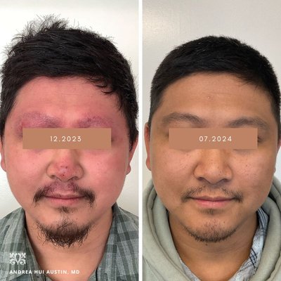 Bay Area Cosmetic Dermatology Updated March 2026 288 Photos 444