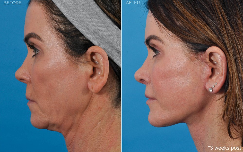 PONSKY FACIAL PLASTIC SURGERY - Updated May 2026 - 37 Photos - 3700 ...