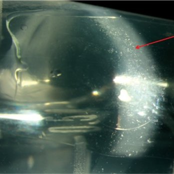 SHARPEVISION MODERN LASIK & LENS - Updated December 2025 - 50 Photos ...