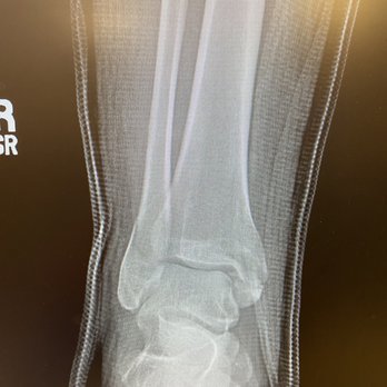 NORTHERN INYO HOSPITAL - Updated May 2024 - 19 Reviews - 150 Pioneer Ln ...