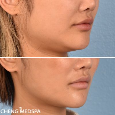 CHENG PLASTIC SURGERY - Updated January 2026 - 153 Photos & 441 Reviews ...