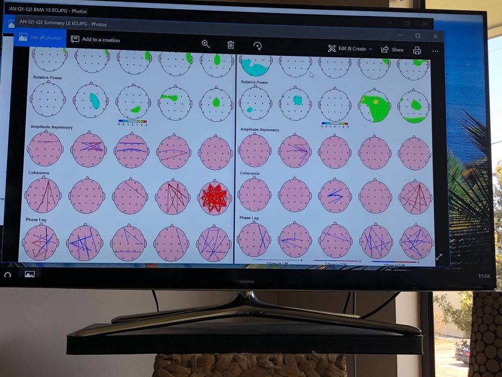 NEUROFIELD NEUROTHERAPY - Updated December 2025 - 17 Photos & 21 ...