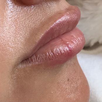 NAKEDMD - Updated January 2026 - 172 Photos & 81 Reviews - 1150 S ...